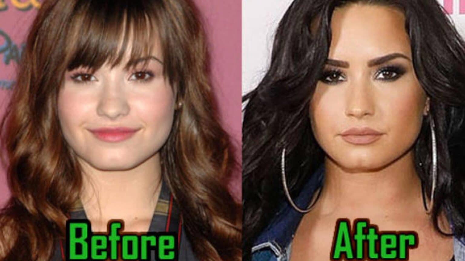 Has Demi Lovato Ever Had Plastic Surgery? | SurgeryTR