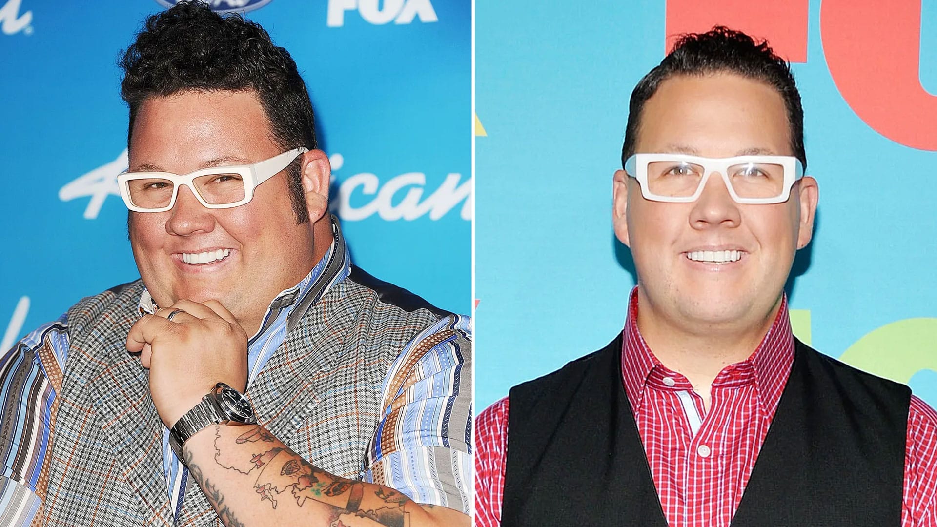 MasterChef Judge Graham Elliot Weight Loss Surgery | SurgeryTR
