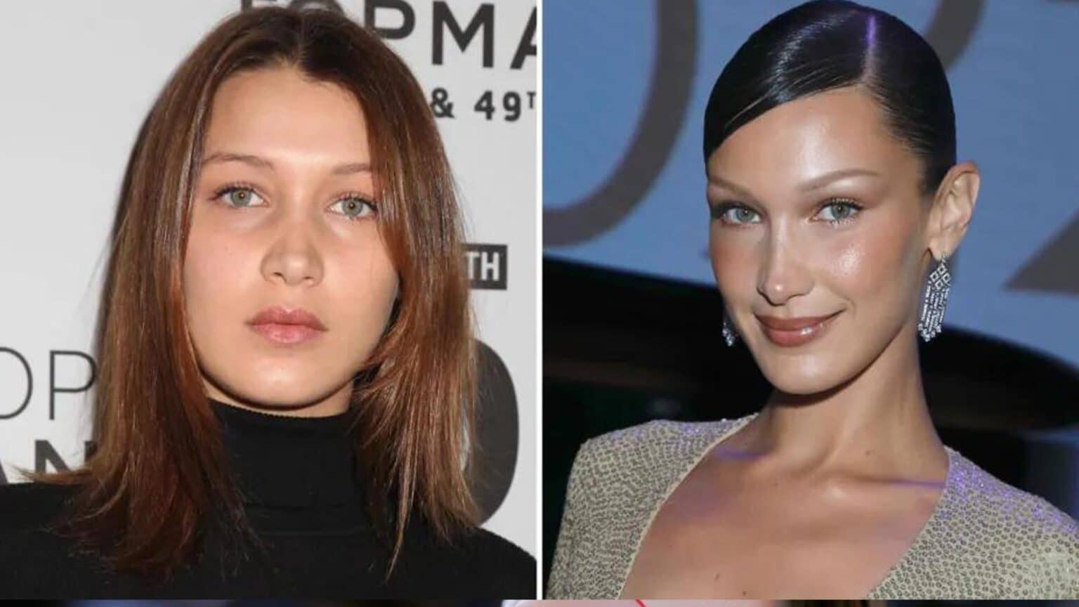 Bella Hadid’s Plastic Surgeries | SurgeryTR