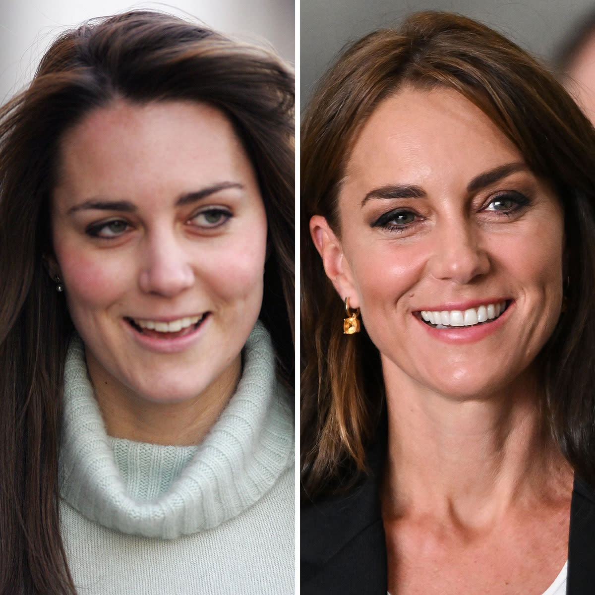 Did Kate Middleton Get Plastic Surgery? Is It Allowed in the Royal ...